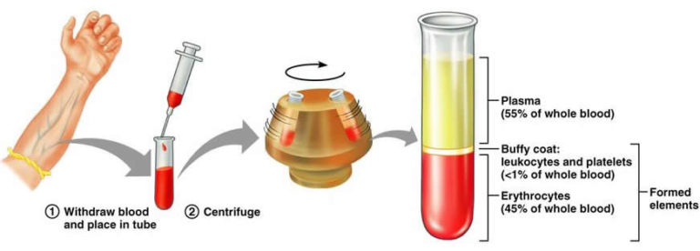 Platelet-Preparation | Hawaii's Innovator in Platelet Rich Plasma (PRP ...